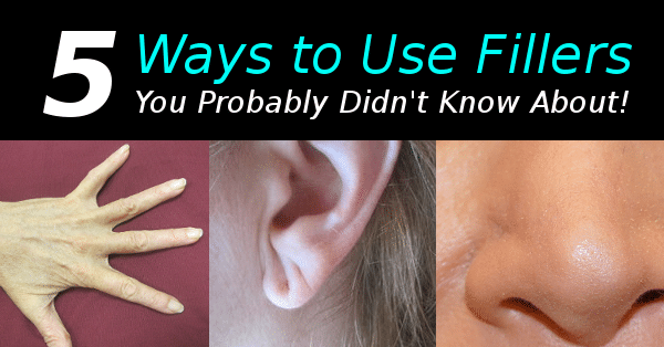 5 Ways To Use Fillers You Probably Didn't Know About! - Dr. Shel ...